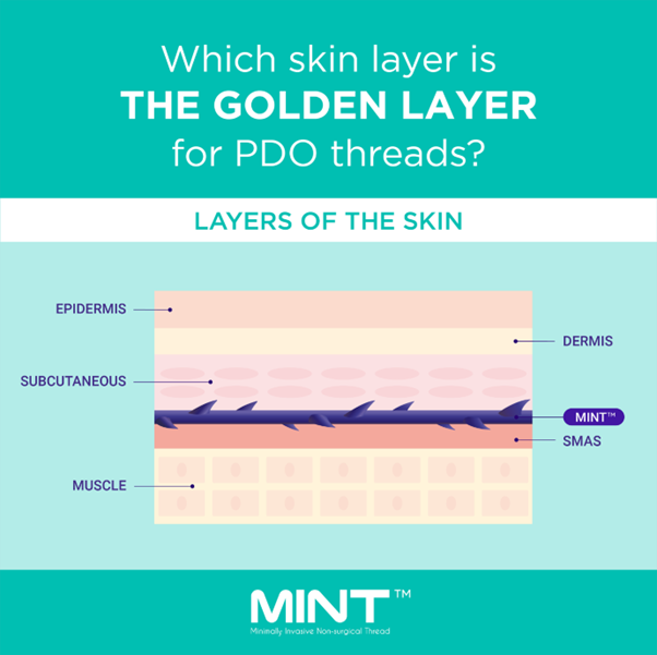 MINT PDO Threads – Face & Neck Lift – Medics Aesthetics Antrim